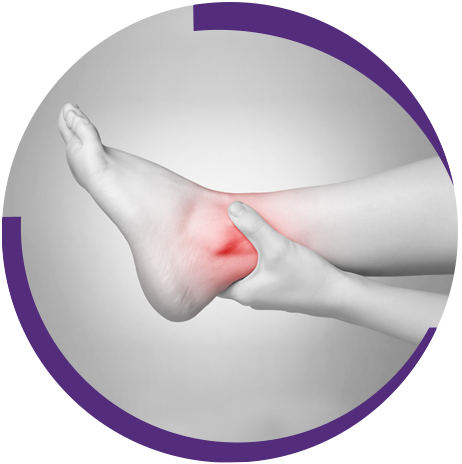 Chronic Ankle Instability - Sole Motion